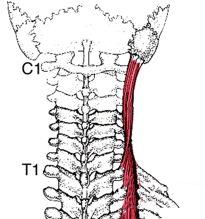 Longissimus capitis_muskel - Zone44