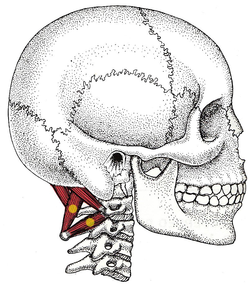 Obliquus_rectus_capitis_lat_muskel_trg - Zone44