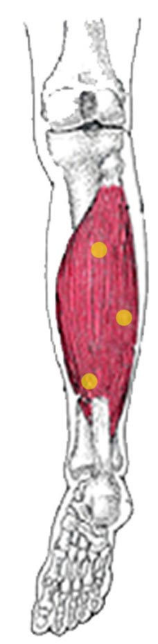Soleus_muskel_trg - Zone44